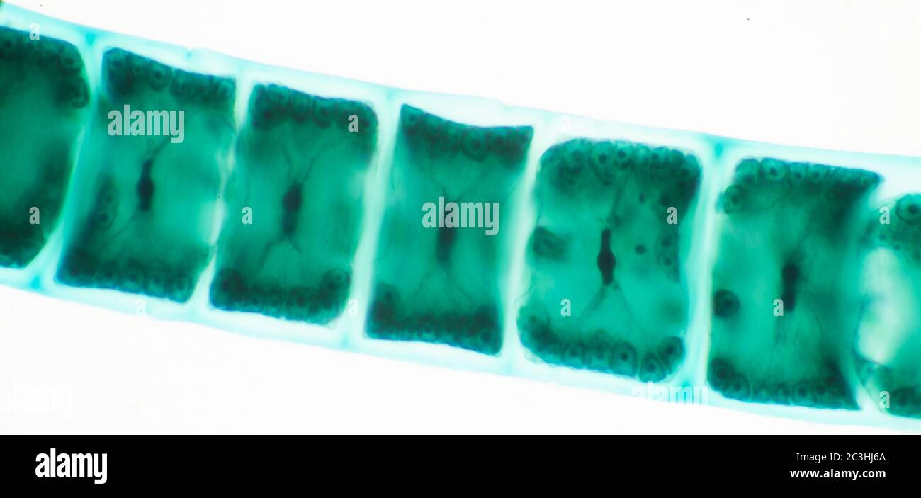 Spirogyra Under Compound Microscope