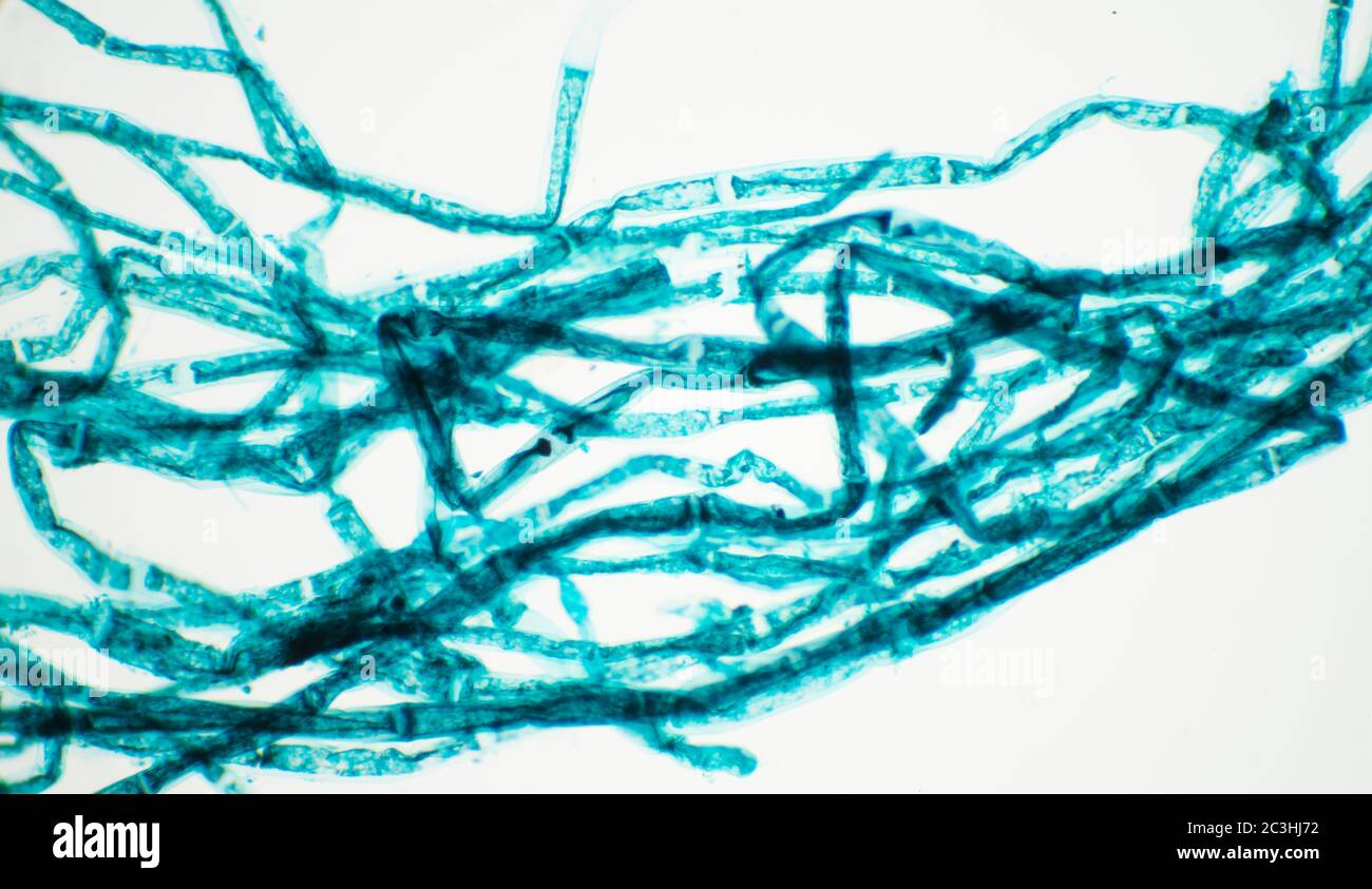 Cladophorales freshwater algae, microscope view Stock Photo - Alamy