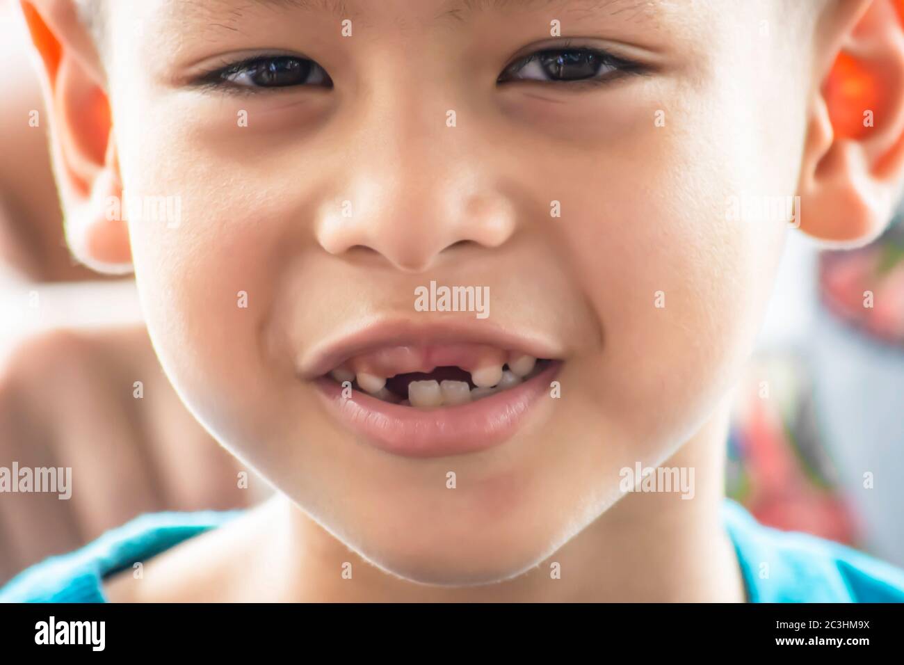 Baby teeth loss hi-res stock photography and images - Alamy