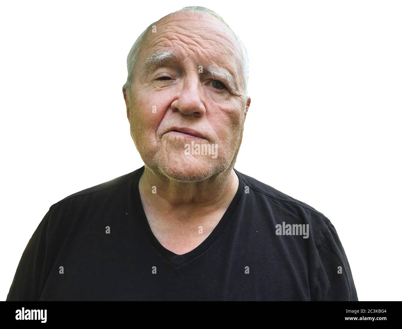 Elderly Person Suffering From Bell s Palsy Stock Photo Alamy