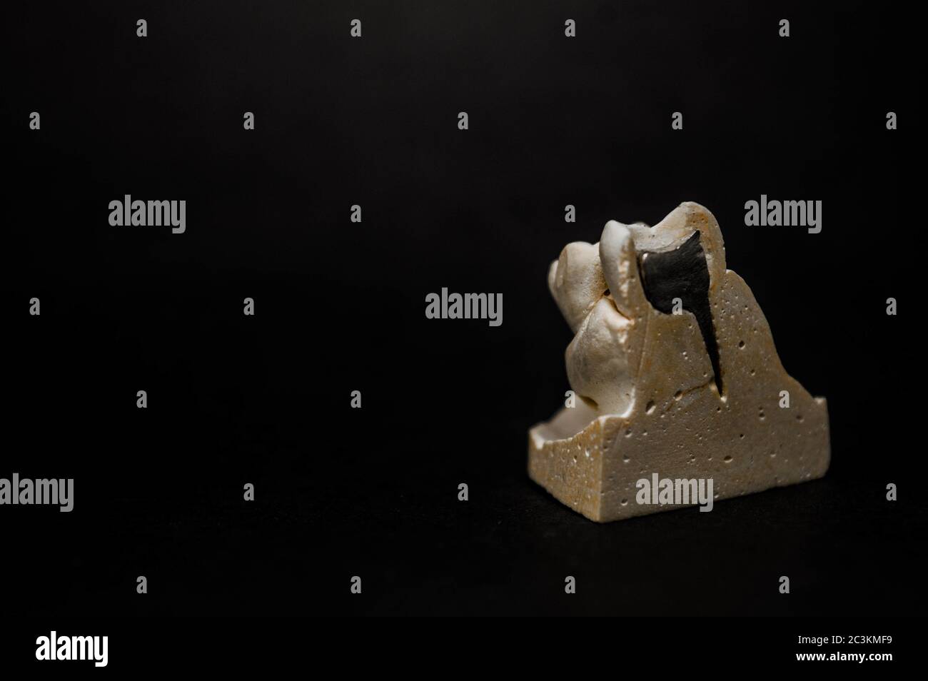 Dental caries cross section hi-res stock photography and images - Alamy
