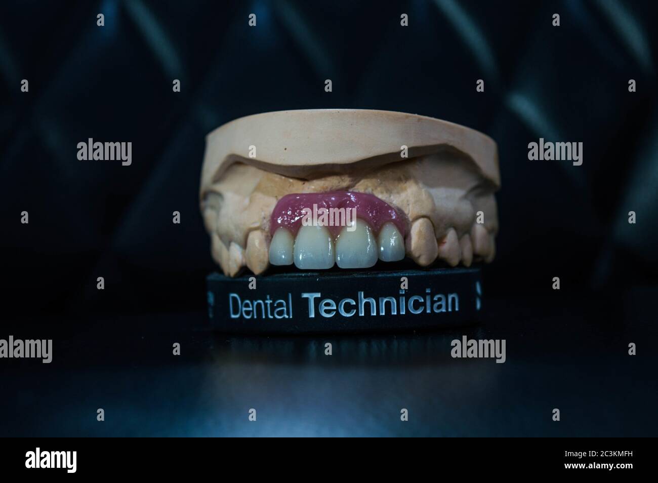 View of an artificial jaw showing the teeth on a stand with a dark ...