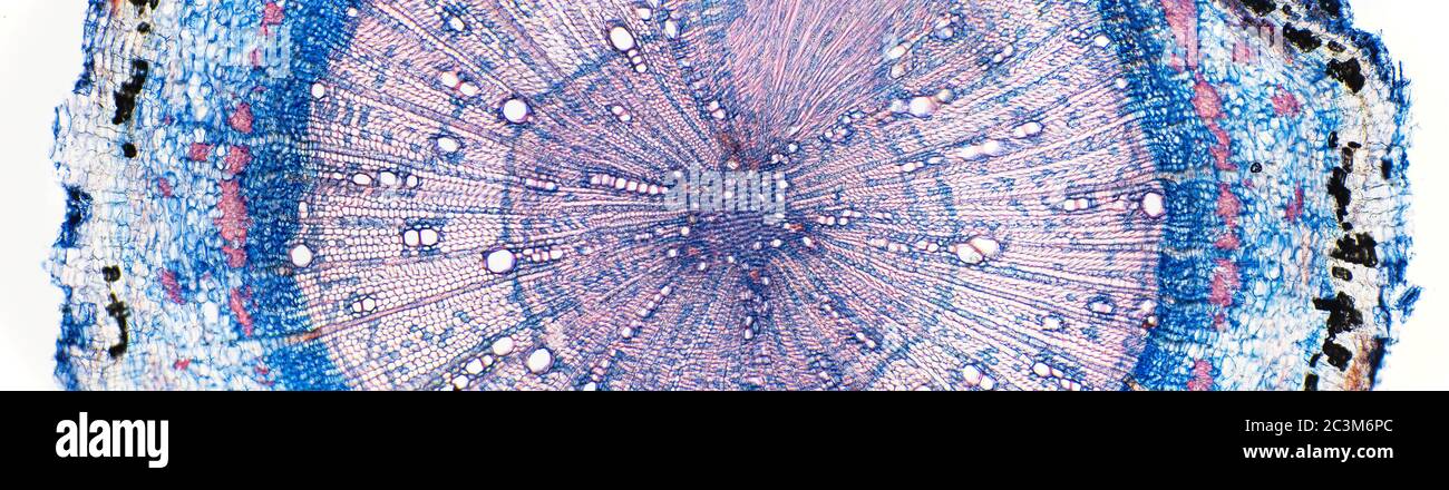 Ash tree root, transverse section, microscope view Stock Photo - Alamy