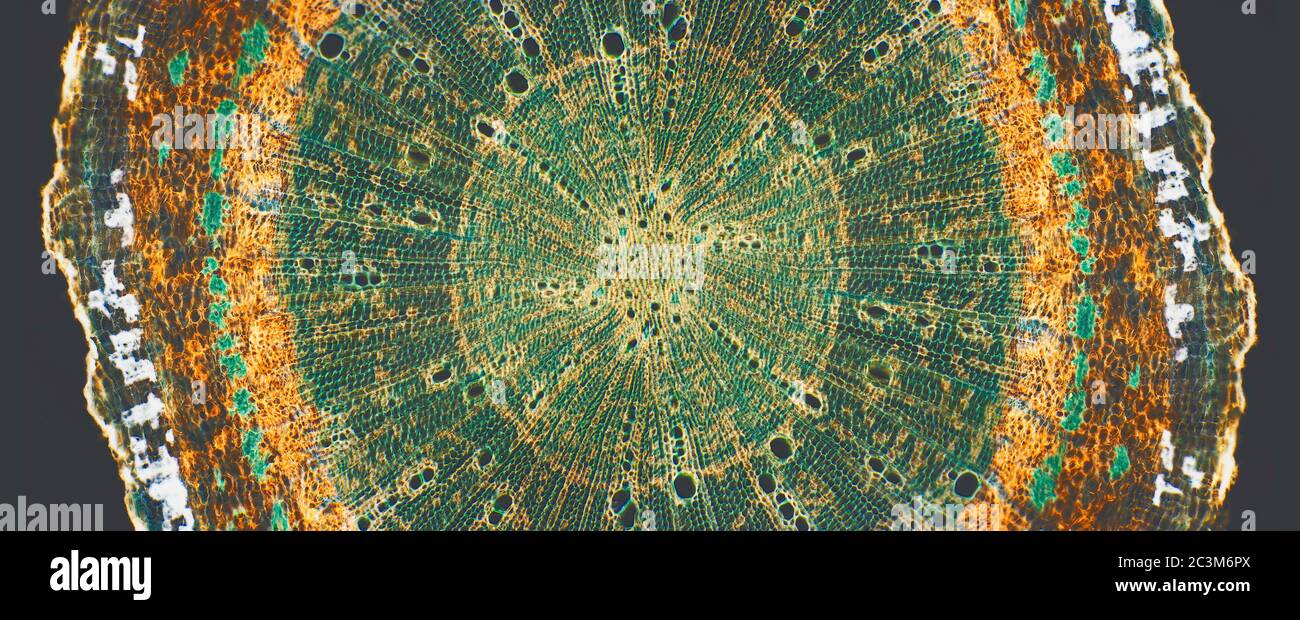 Ash tree root, transverse section, microscope view Stock Photo - Alamy