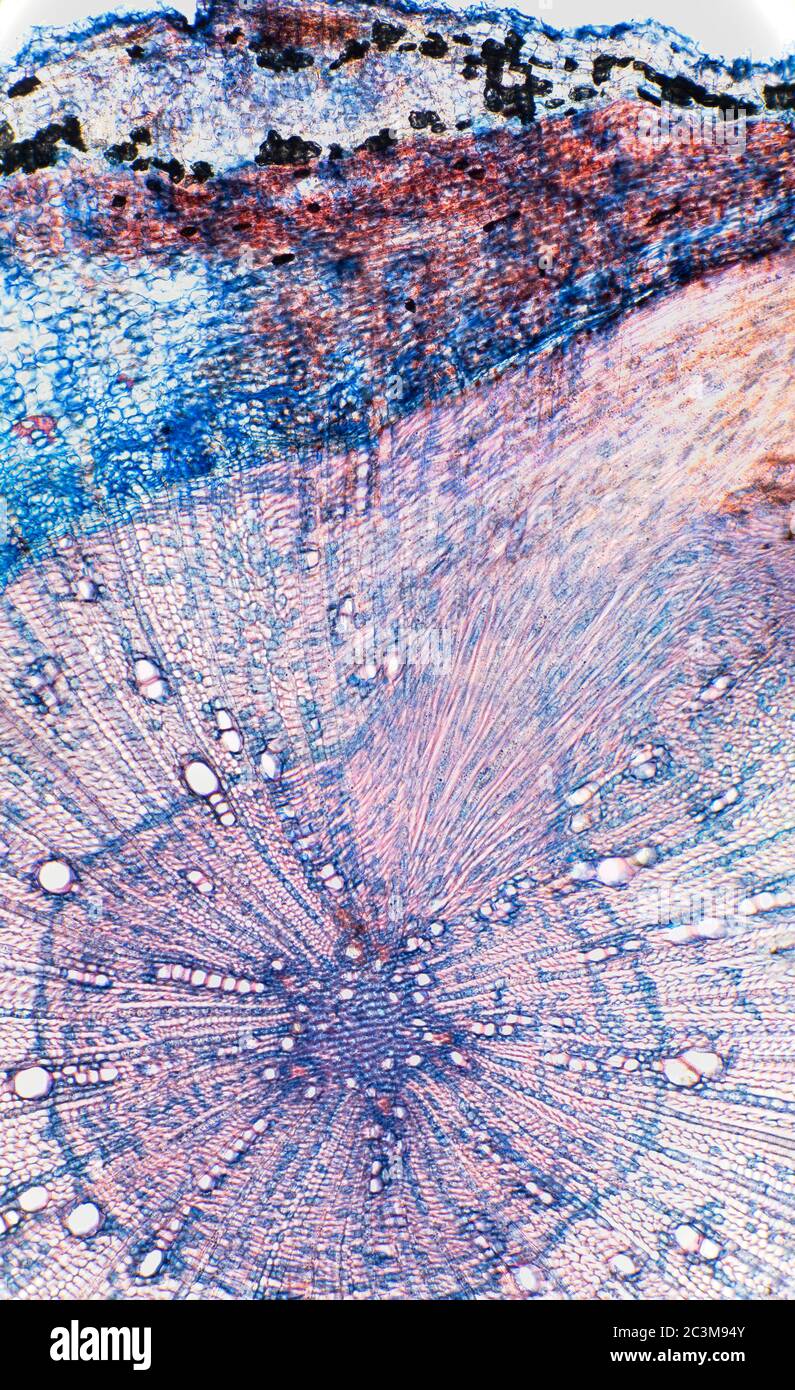 Ash tree root, transverse section, microscope view Stock Photo - Alamy