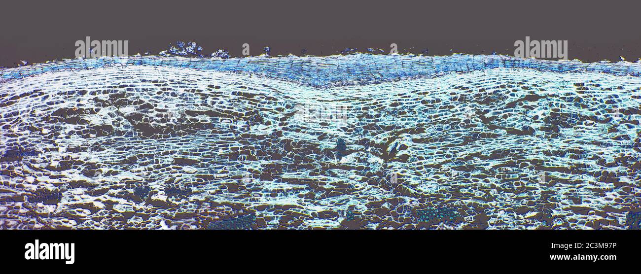 Sweet Chestnut tree bark, microscope view Stock Photo - Alamy