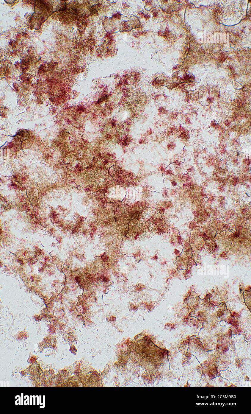 Penicillium fungi hi-res stock photography and images - Alamy