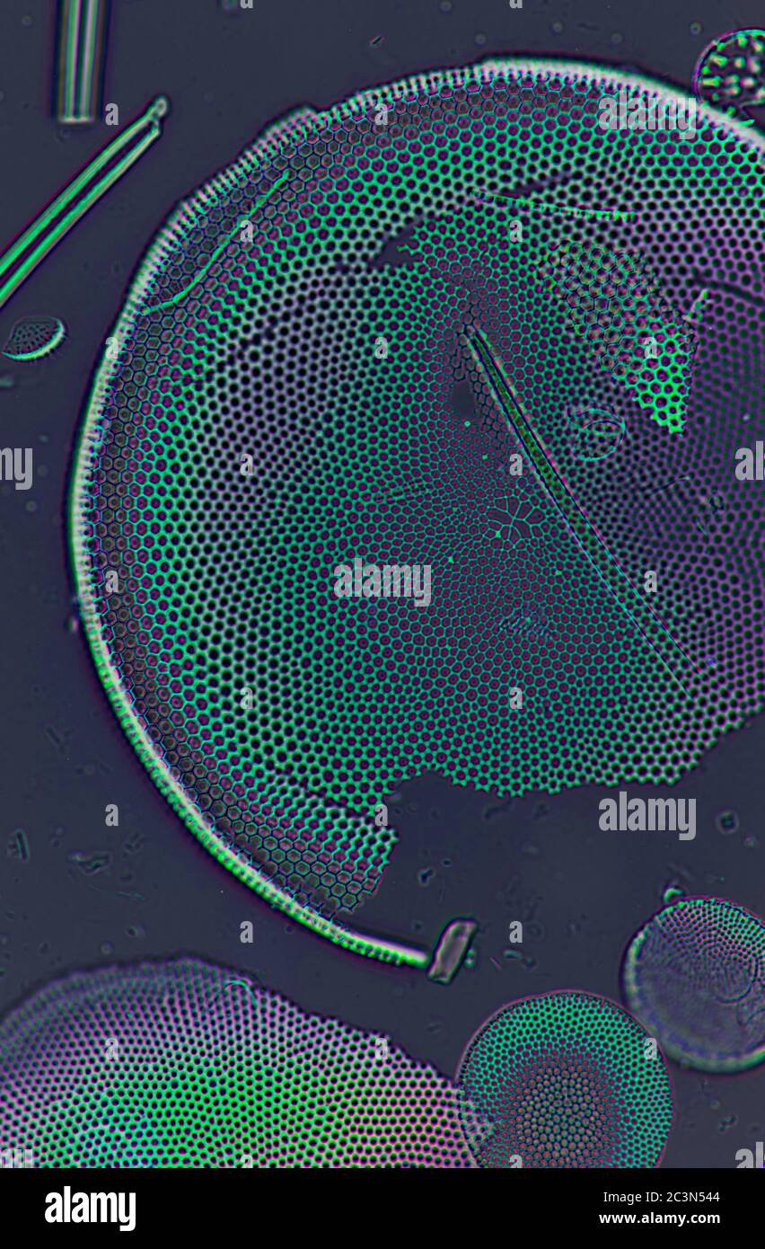 Diatoms microscope hi-res stock photography and images - Alamy