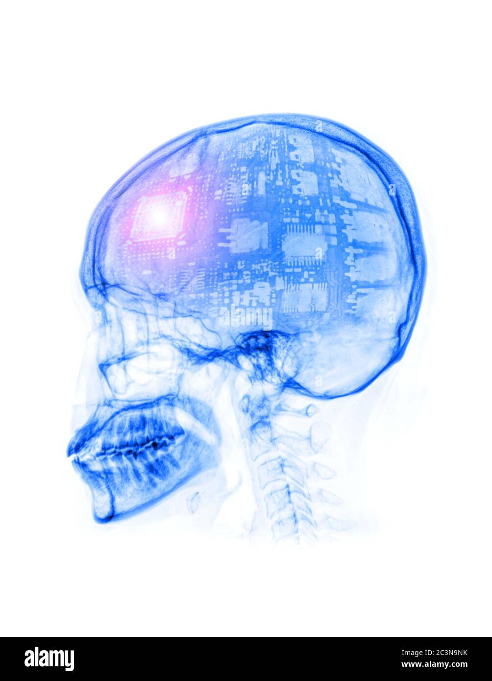 Intellectual thinker , Human skull x-ray with CPU for technology ...