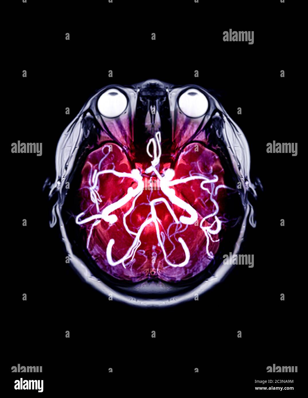 Human brain axial mri scan hi-res stock photography and images - Alamy