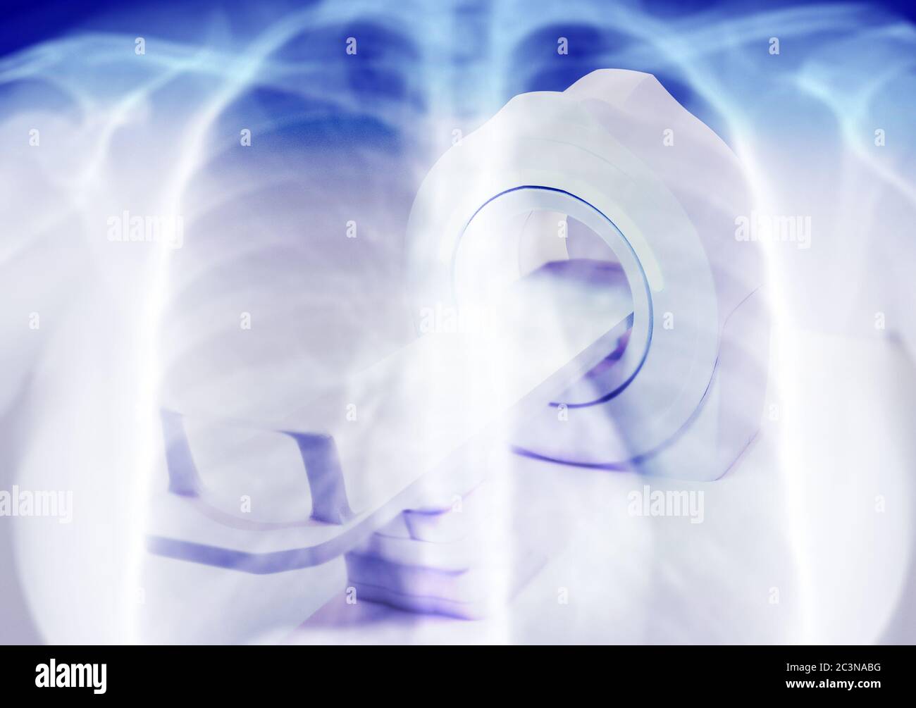 Fusion image of multi detector CT Scanner ( Computed Tomography ) on ...