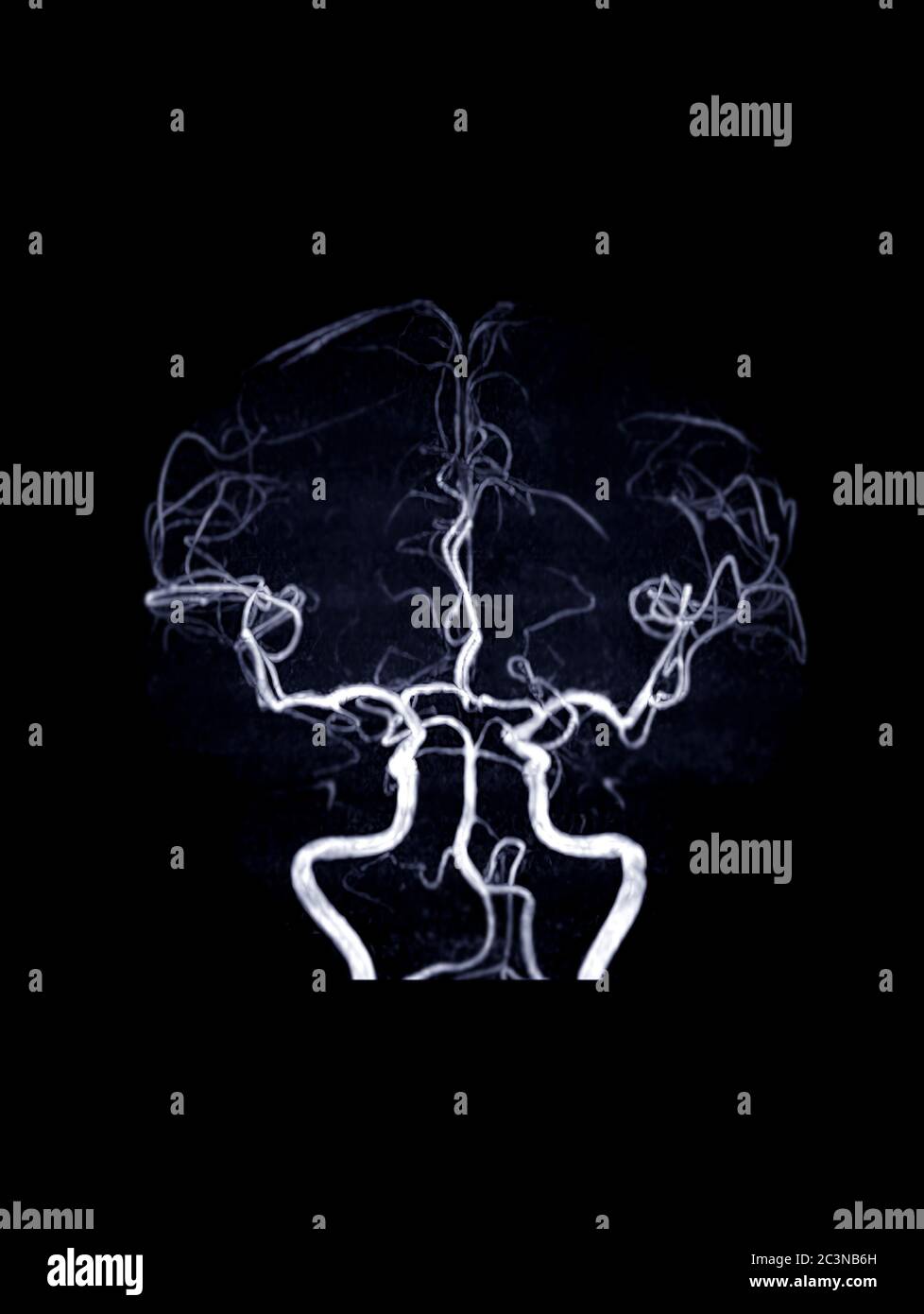 Venous drainage of the brain hi-res stock photography and images - Alamy