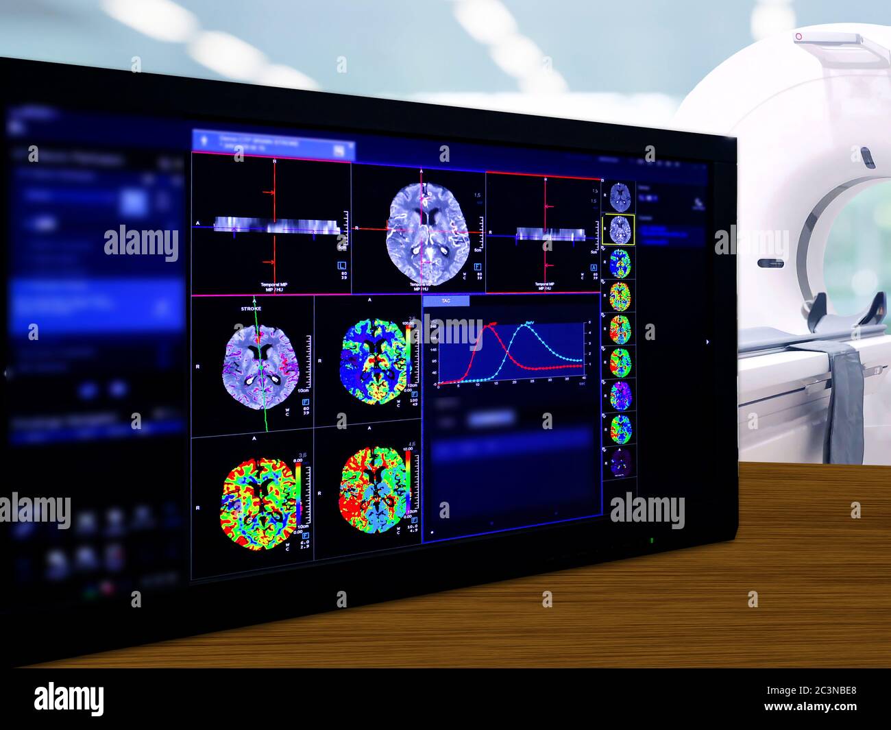 Brain Perfusion or CT scan of Blood flow in the brain 3d rendering ...
