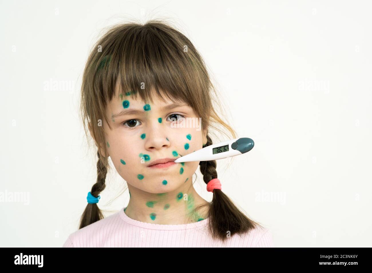 Rashes In Child High Resolution Stock Photography and Images - Alamy