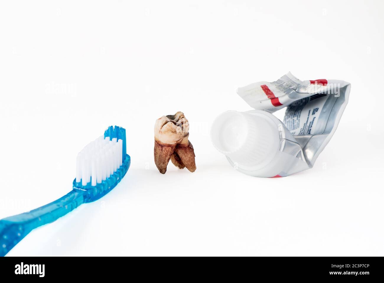 single extracted molar tooth with caries decay and filling with tooth ...