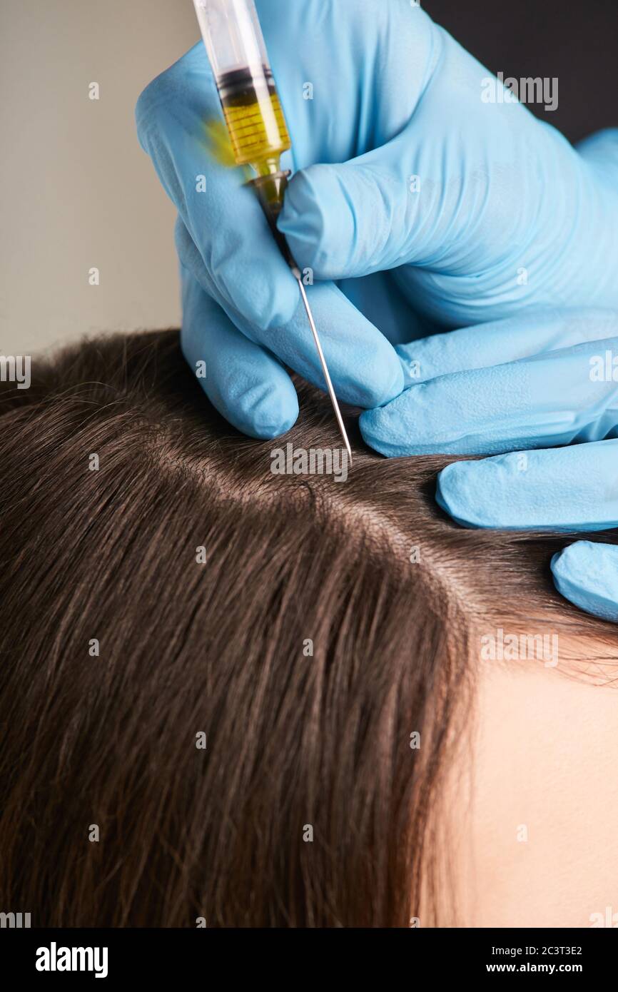 Hair injection. Loss damaged at clinic. Female and doctor Stock Photo ...