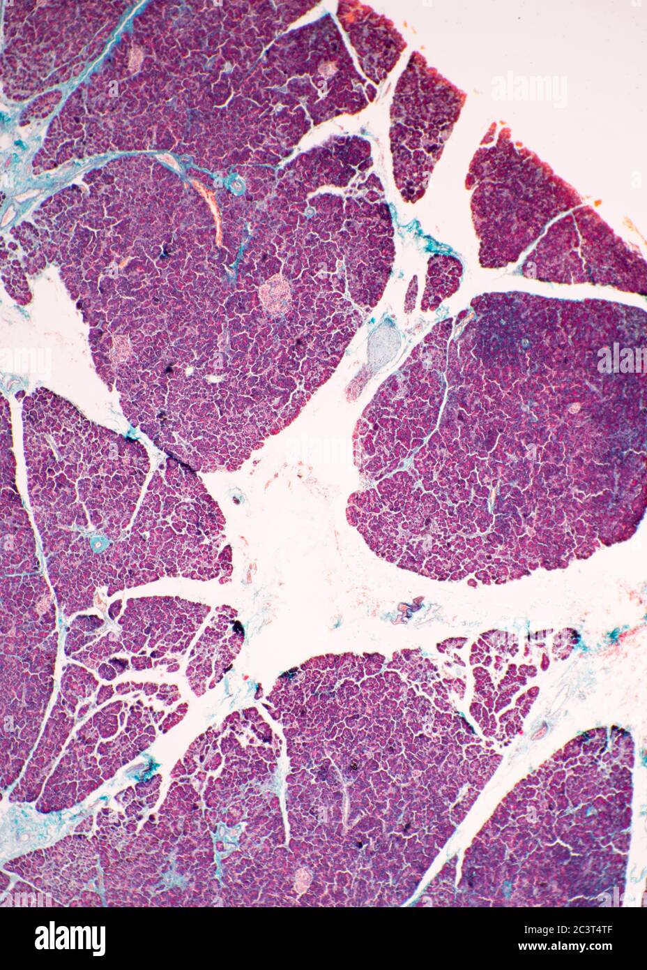 Pancreas, stained thin section, microscope view Stock Photo - Alamy