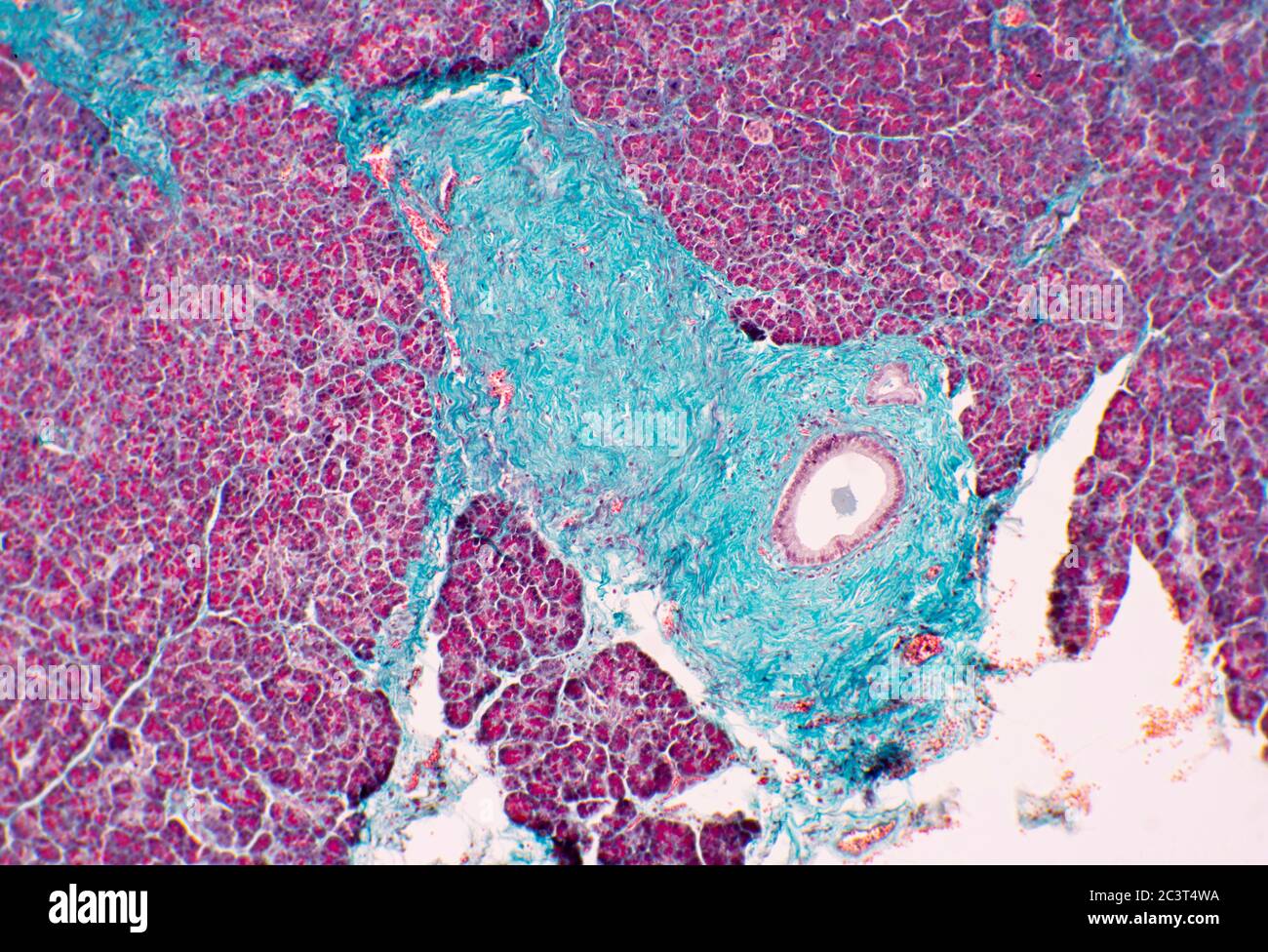 Islets of langerhans hi-res stock photography and images - Alamy