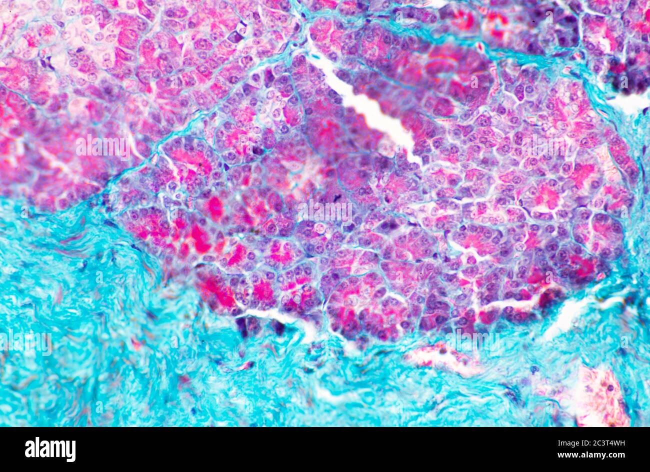 Pancreas, stained thin section, microscope view Stock Photo - Alamy