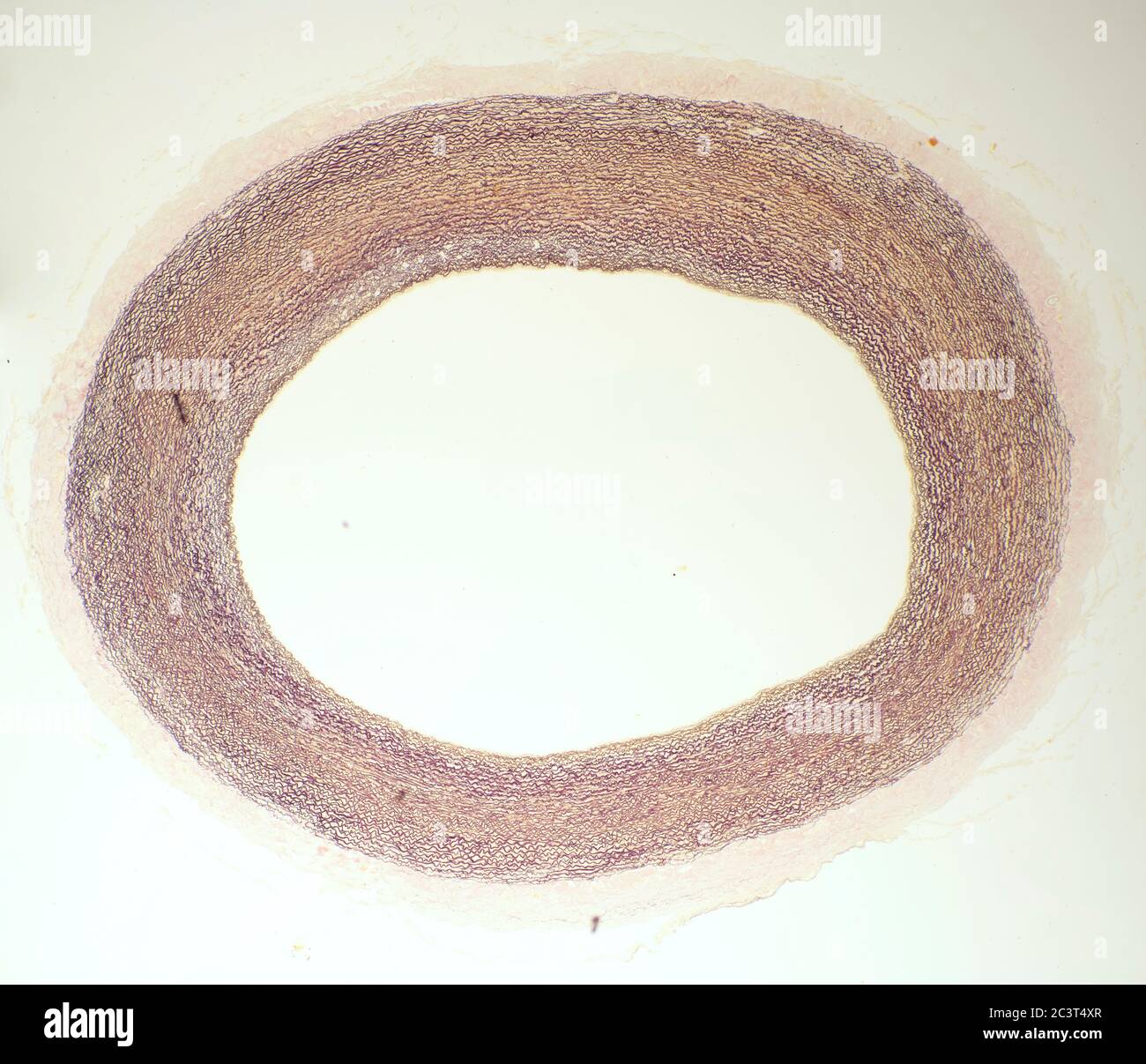 Cross section of animal Aorta, the main artery, microscope view Stock ...