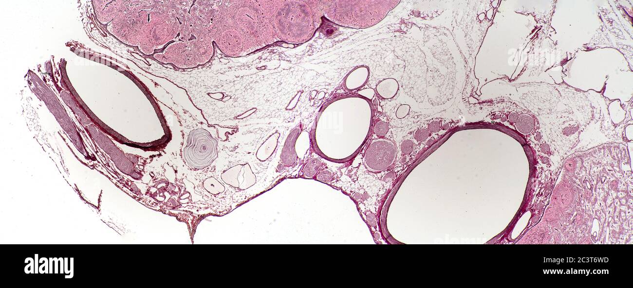 Detail images of Lymph Node, microscope view Stock Photo - Alamy