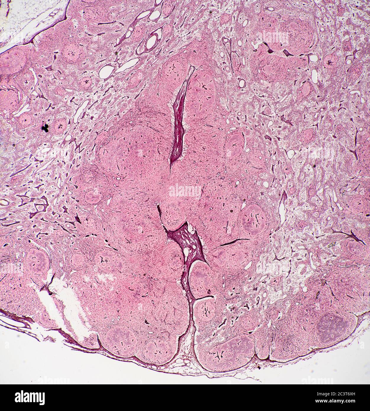 Detail images of Lymph Node, microscope view Stock Photo - Alamy