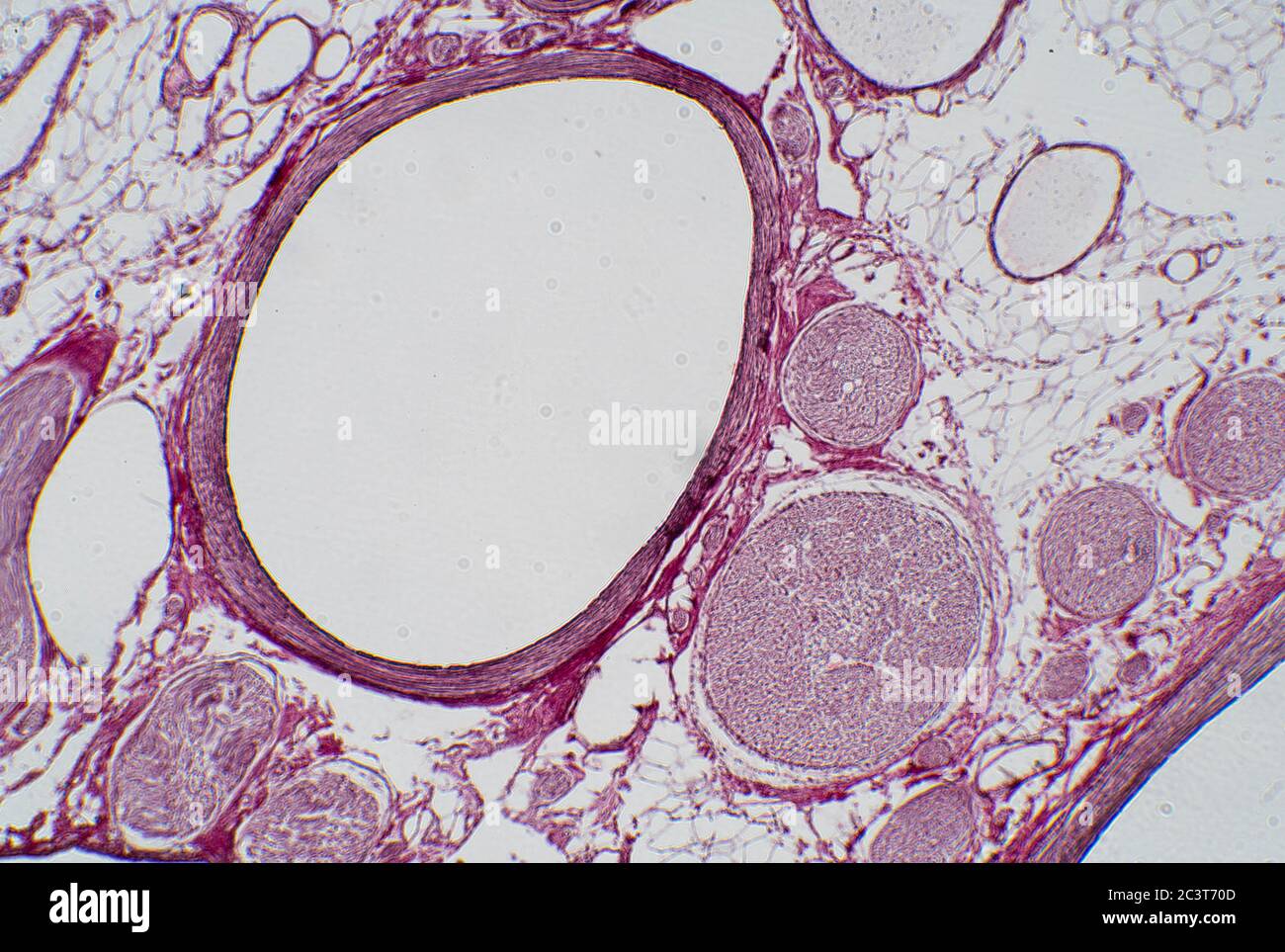 Detail images of Lymph Node, microscope view Stock Photo - Alamy