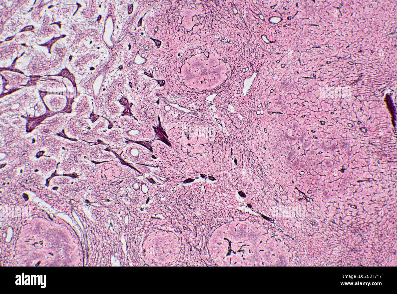 Detail images of Lymph Node, microscope view Stock Photo - Alamy