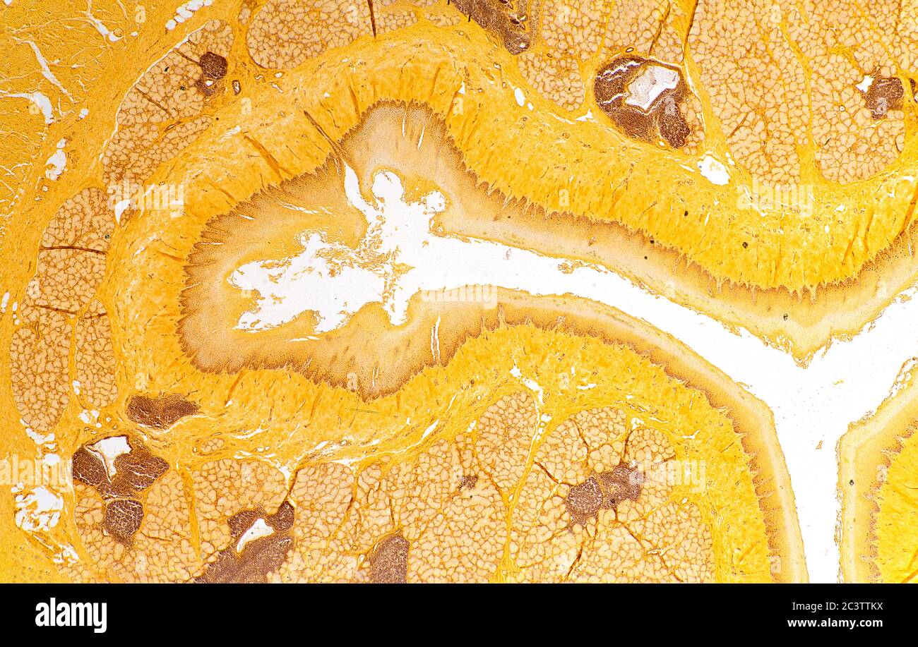 Oesophagus section hi-res stock photography and images - Alamy