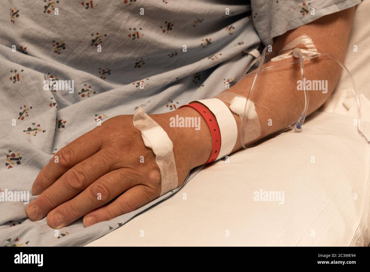 Healthcare scene, arm and hand of man with IV line, wristbands and ...