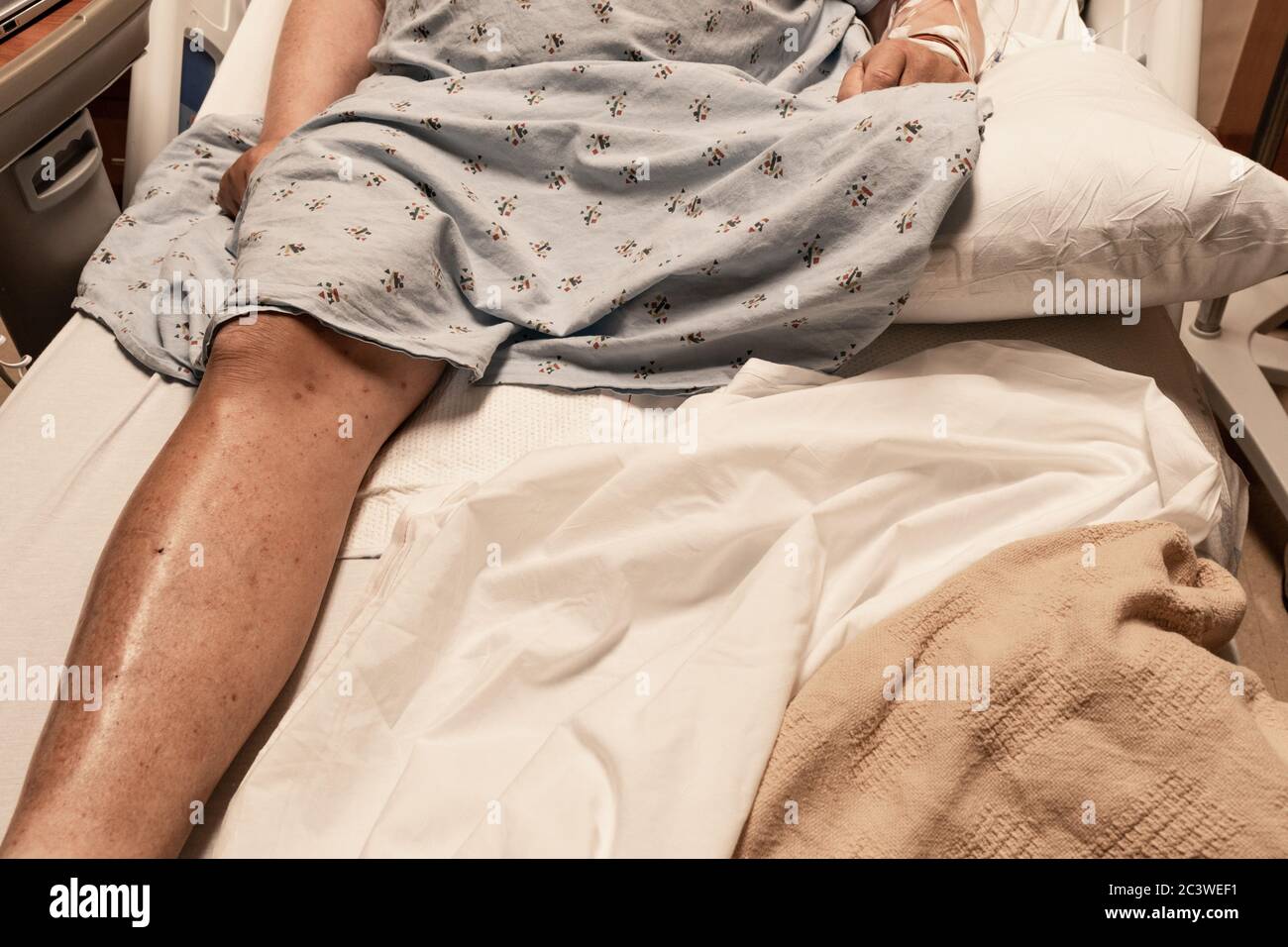 Amputated Leg High Resolution Stock Photography and Images - Alamy