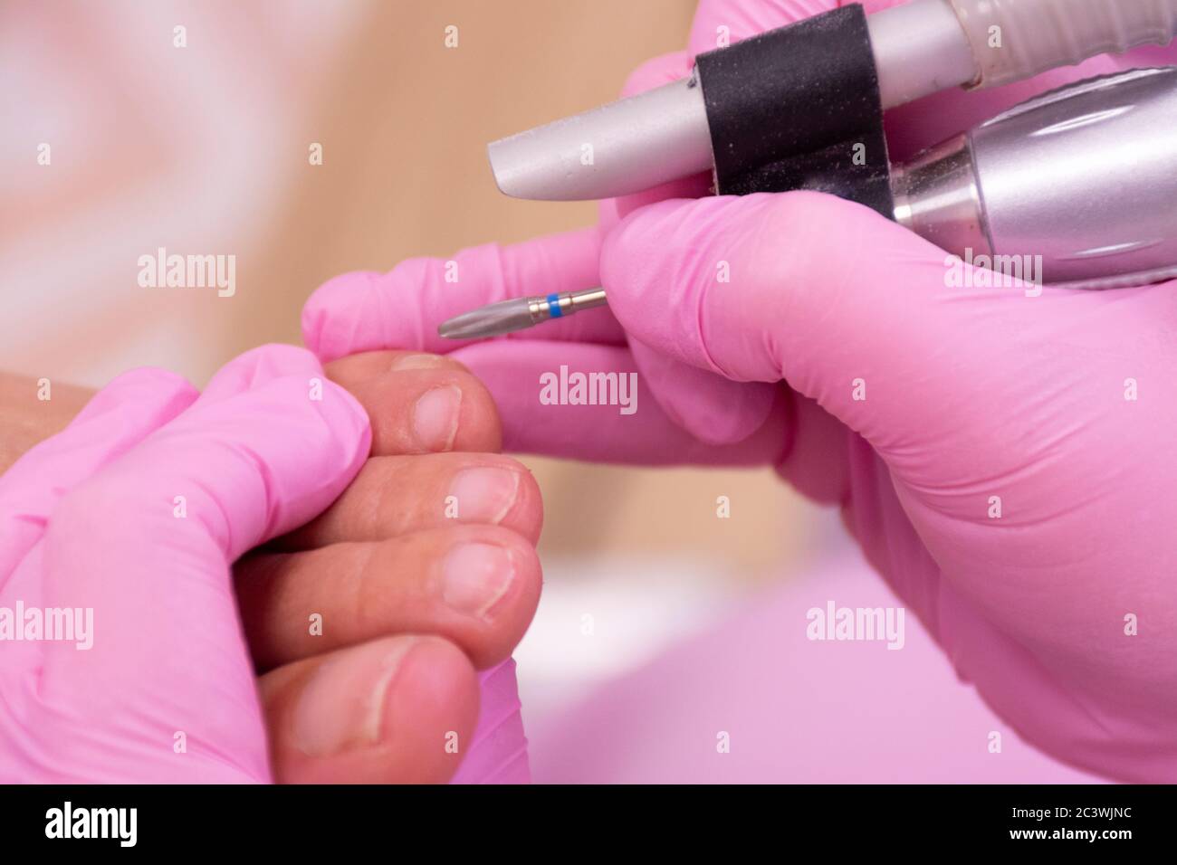 Hands of an unrecognizable female podiatrist with pink gloves filing ...
