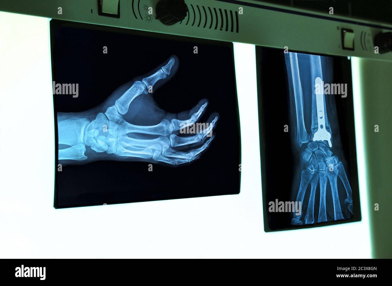 Negatoscope hi-res stock photography and images - Alamy