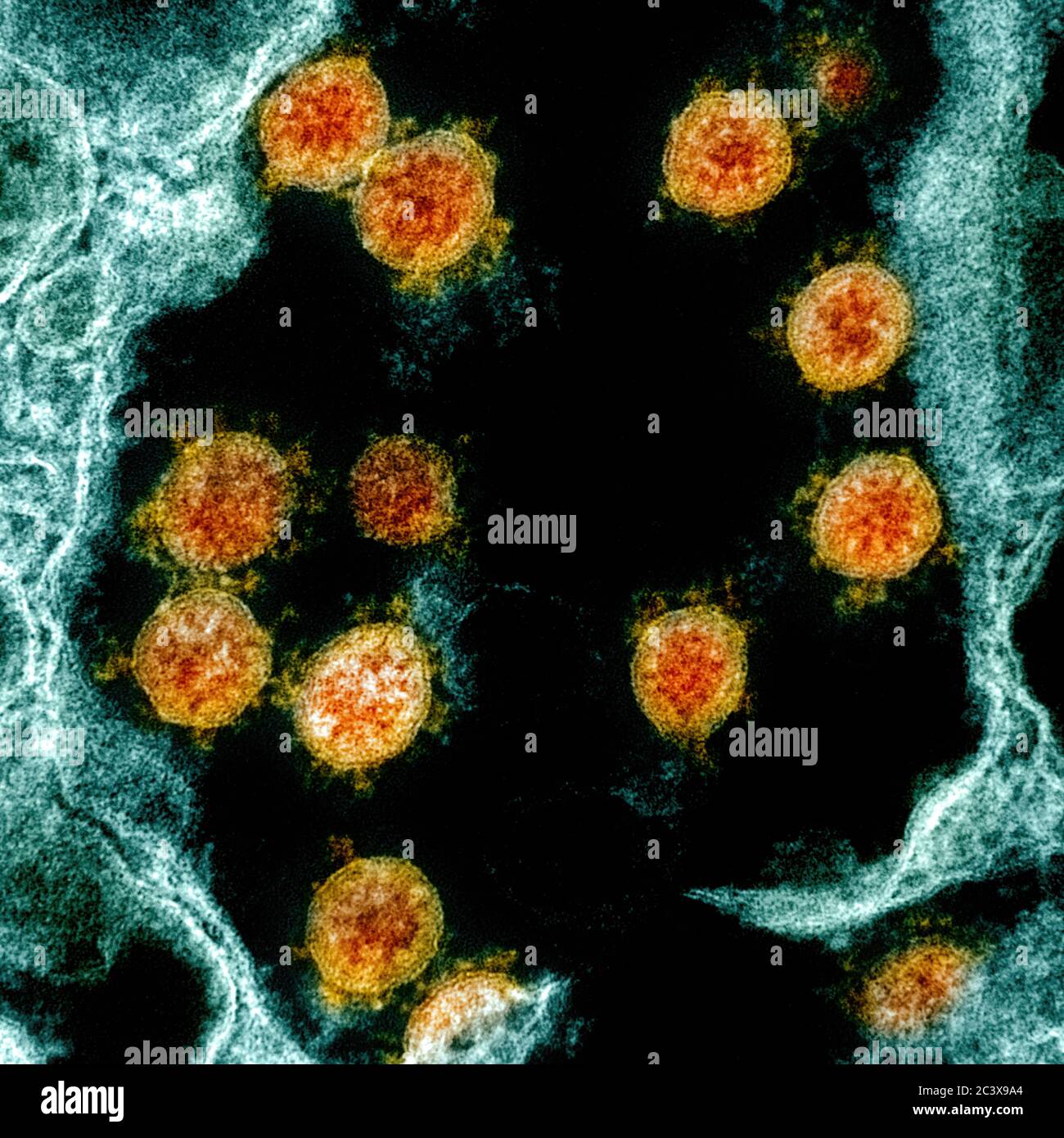 Transmission electron microscope color enhanced hi-res stock ...