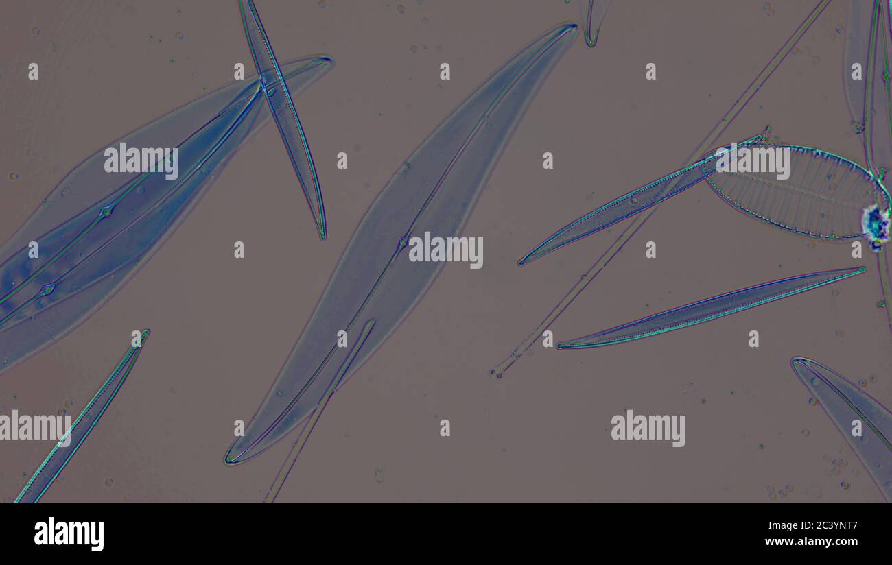 Strewn Diatoms, Pleurosigma angulatum, silica walls, microscope view ...