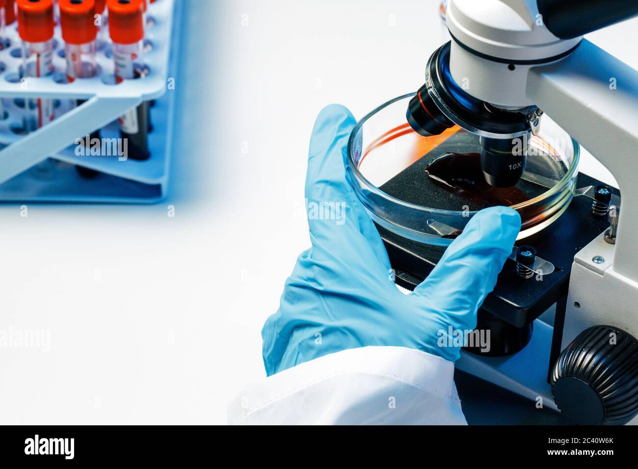 Hands of a laboratory worker doing blood test Stock Photo - Alamy