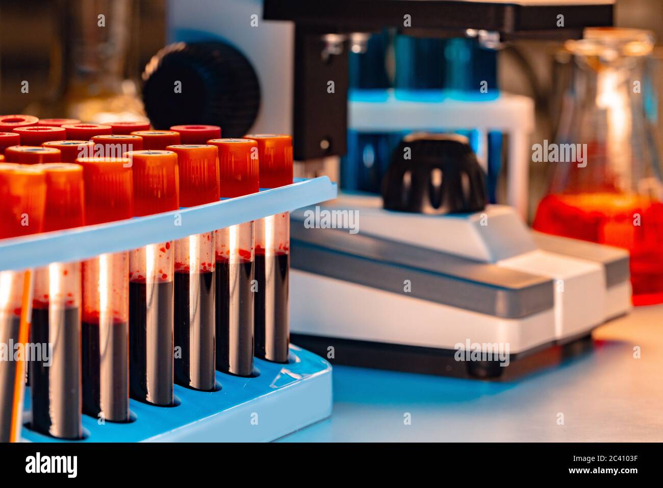 Close up photo of microscope with test tubes with blood samples Stock ...