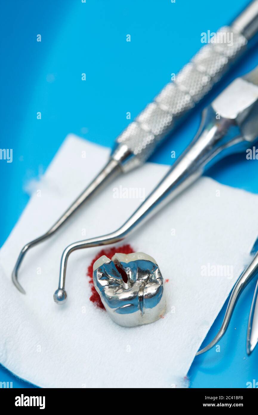 Dental tools and a crown Stock Photo - Alamy