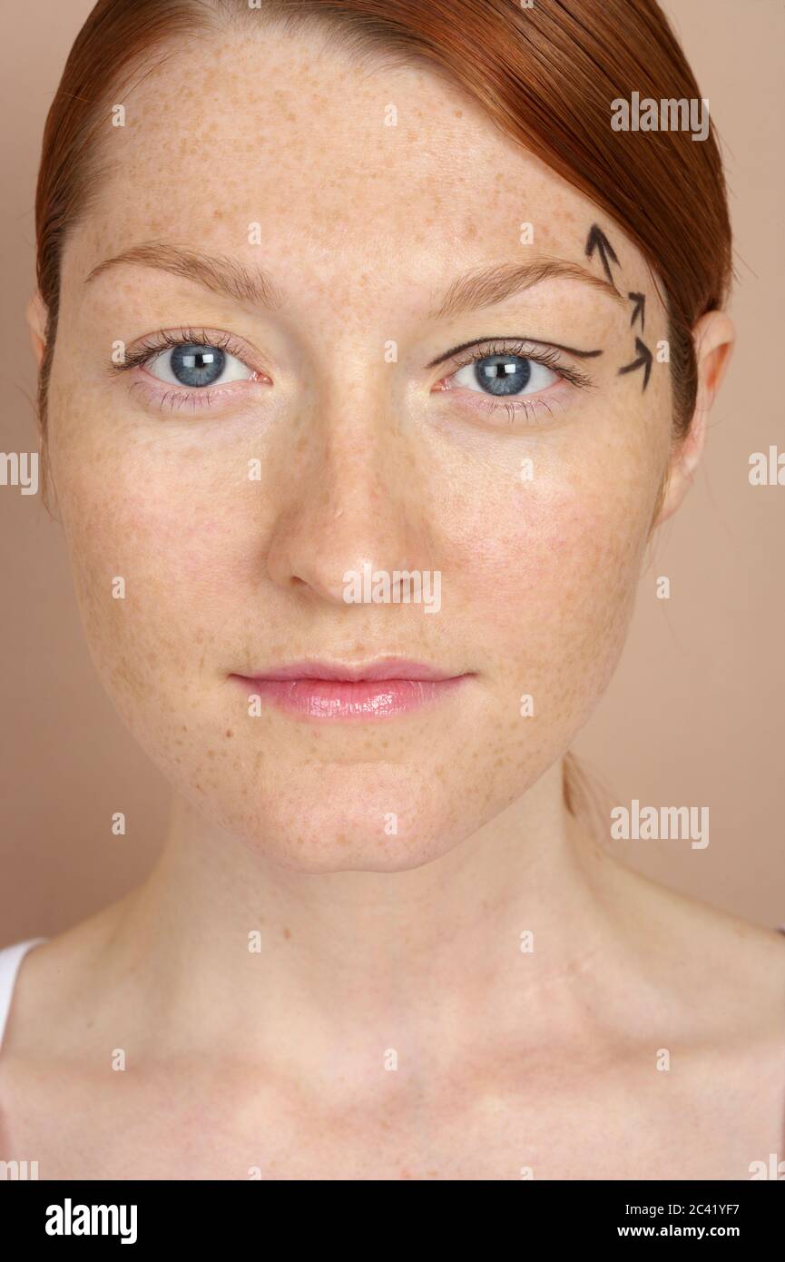 Markings on the face of a young woman - cosmetic surgery Stock Photo ...