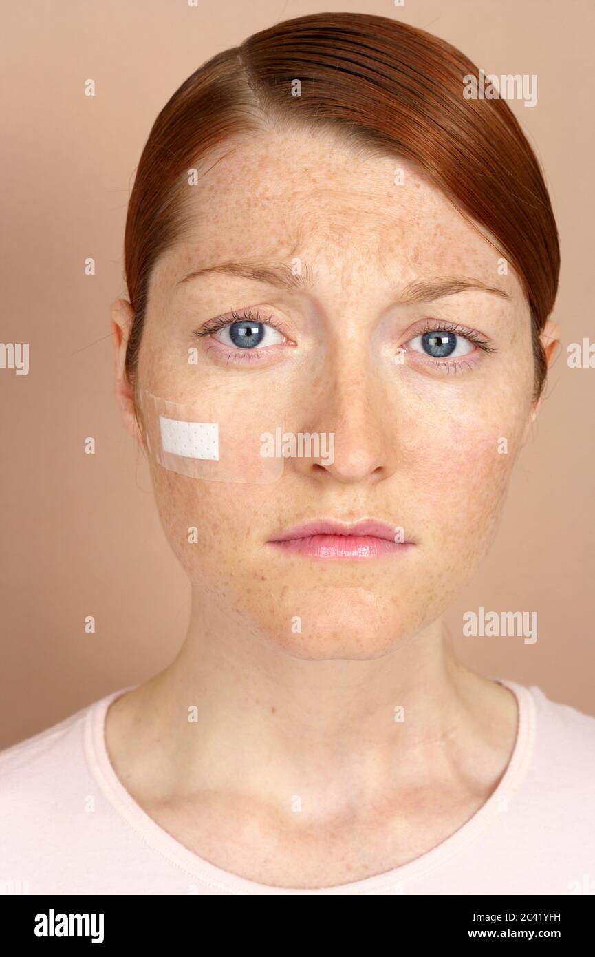 Red-haired woman with a plaster on her face - insecurity - beauty Stock ...