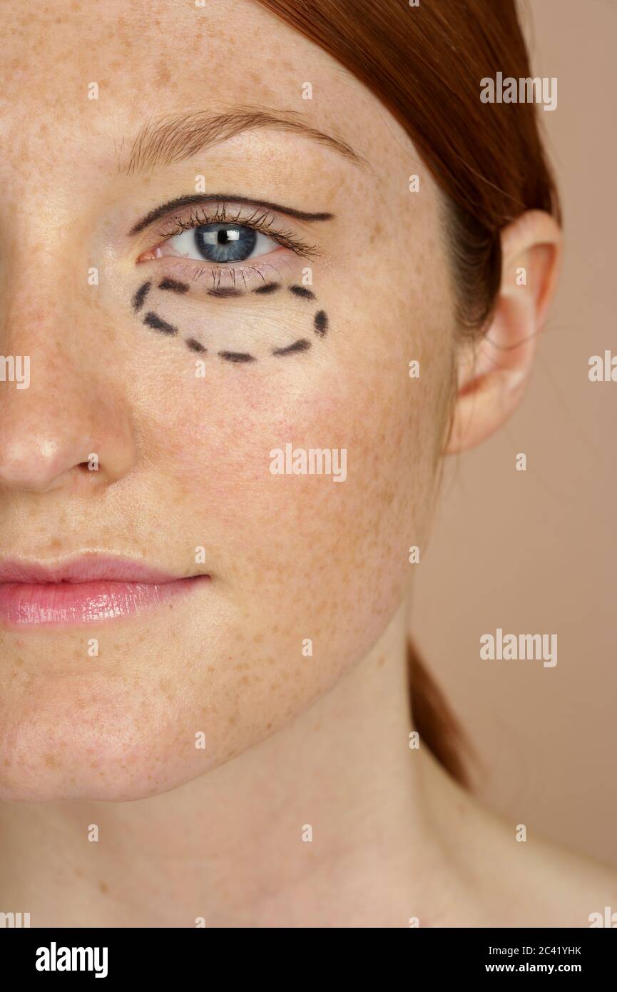 Markings on the face of a young woman - cosmetic surgery Stock Photo ...