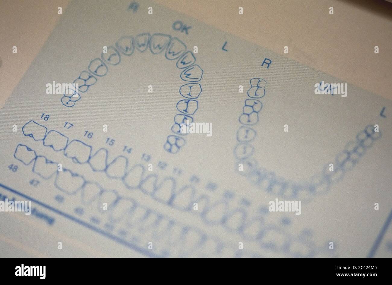 Illustrative representation of the teeth of the upper and lower jaw in ...
