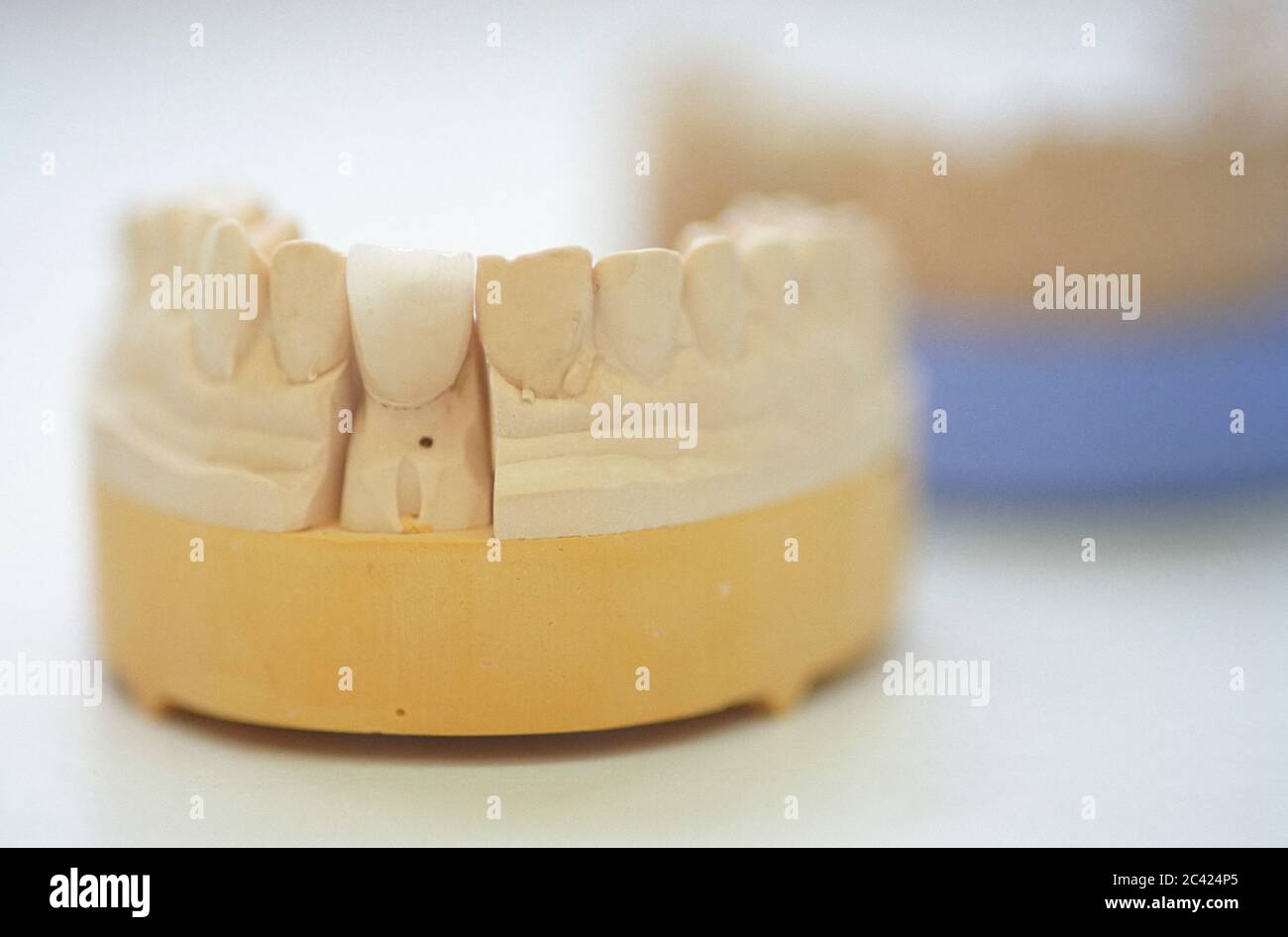 Plaster cast of a human lower jaw - replica - medicine Stock Photo - Alamy