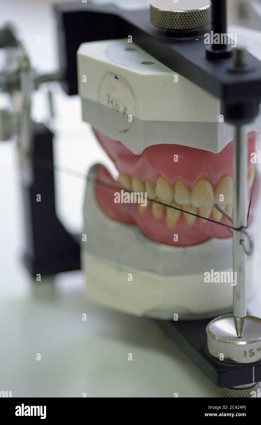 Human dentition in a plaster cast - impression - medicine Stock Photo ...