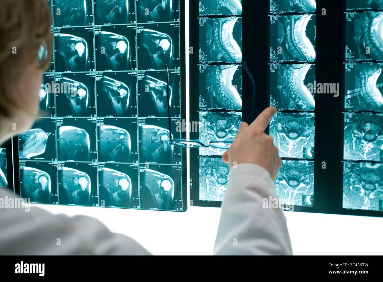 A person points to an x-ray Stock Photo - Alamy
