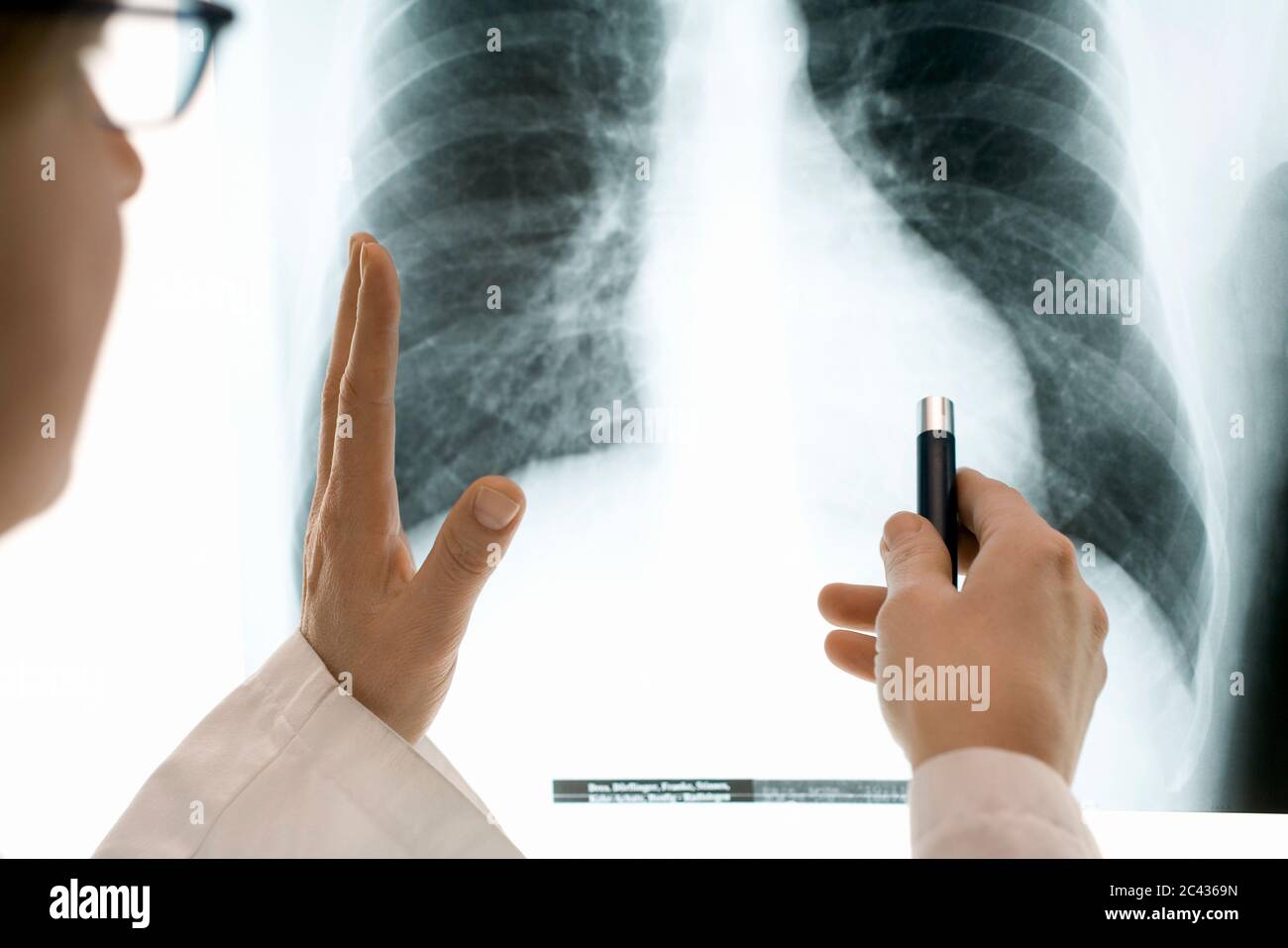 A person points to an x-ray Stock Photo - Alamy