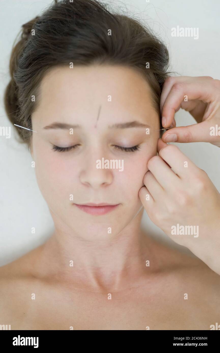 Female acupuncture hi-res stock photography and images - Alamy
