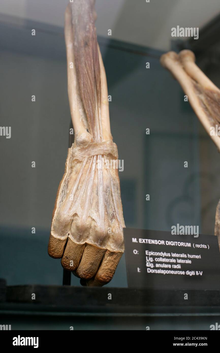 Human arm specimen without skin - Anatomy - Exhibition - Museum Stock ...