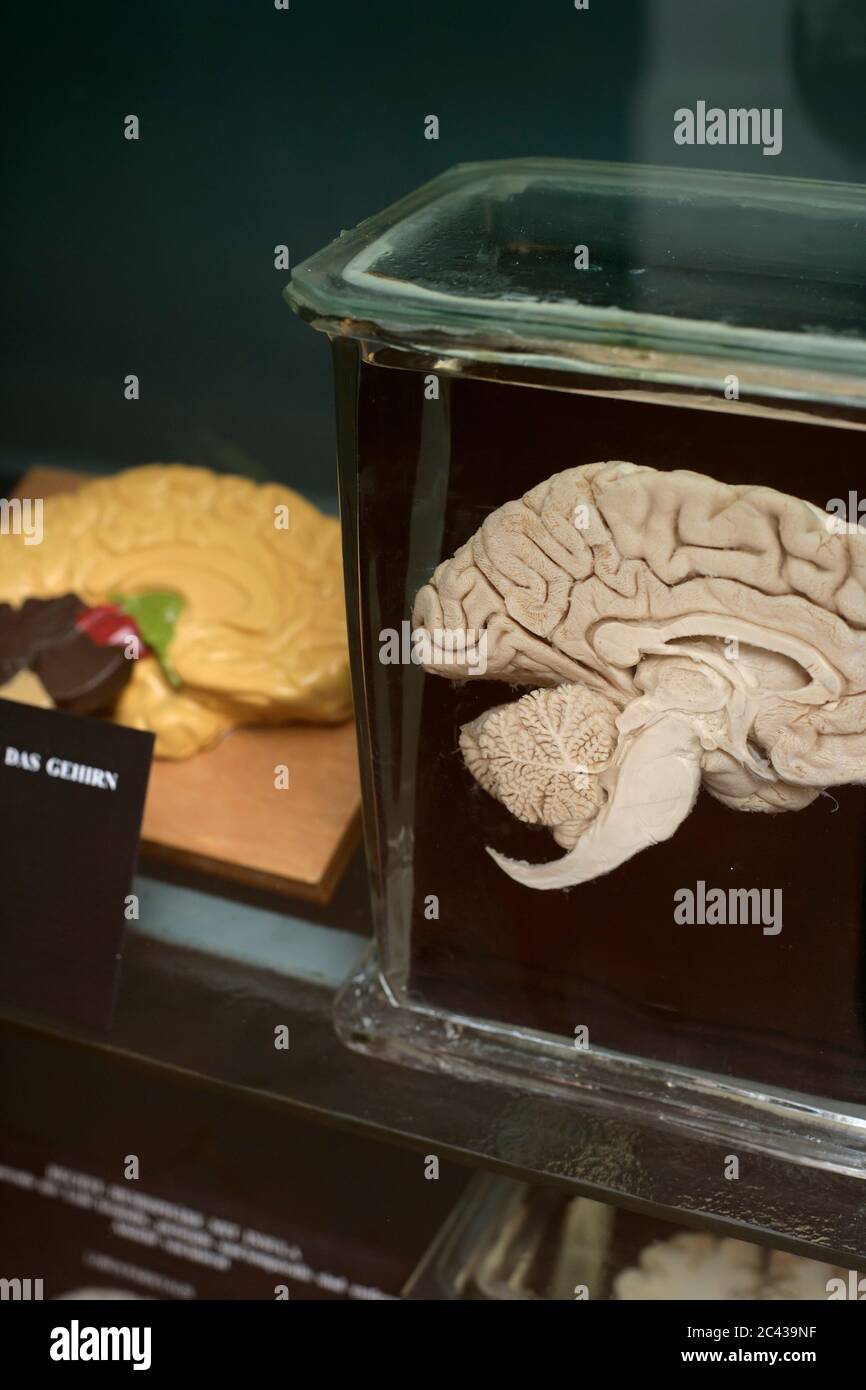 Einstein Brain Preserved