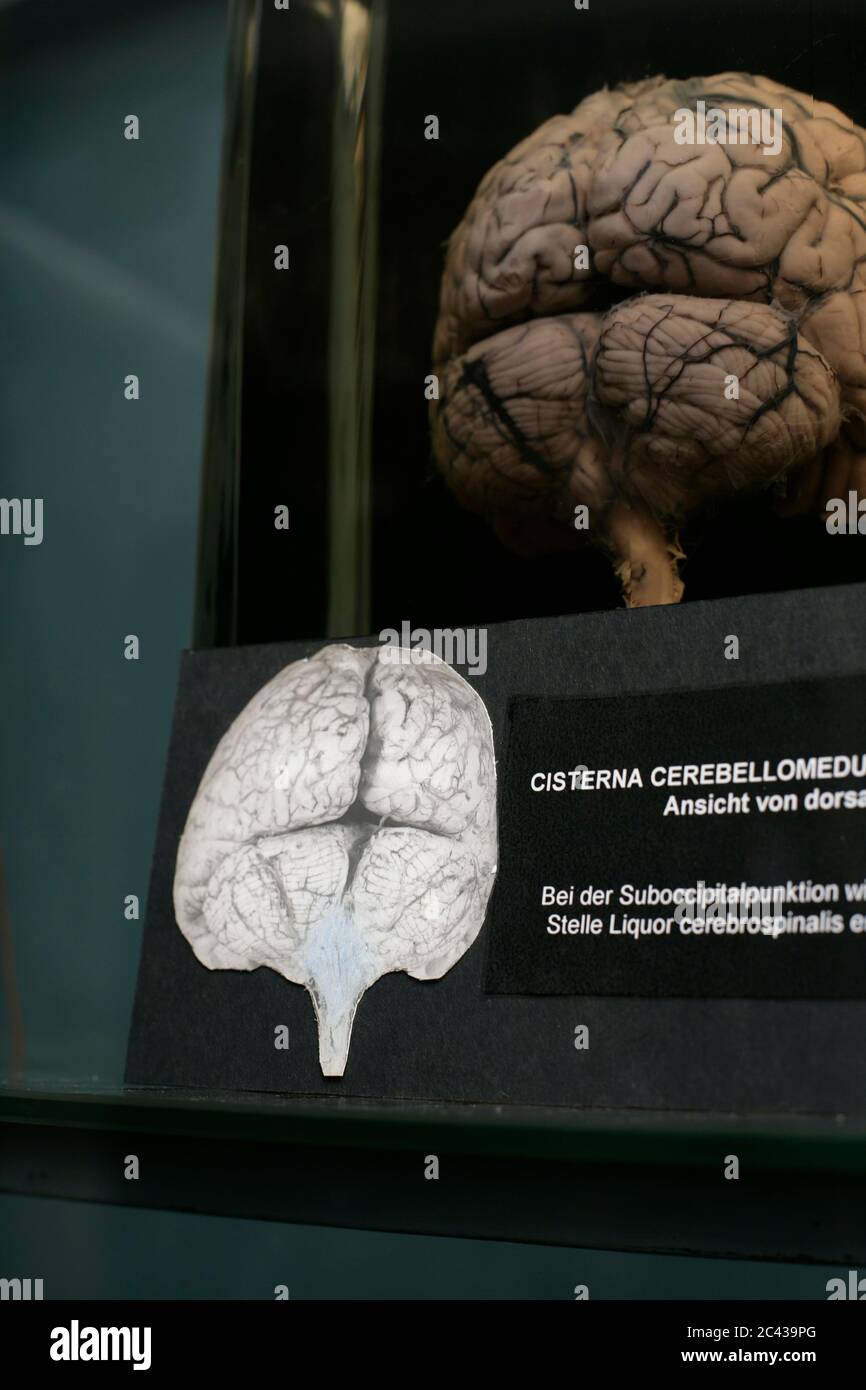 Human Brain Preserved in Liquid - Anatomy - Exhibition - Museum Stock ...